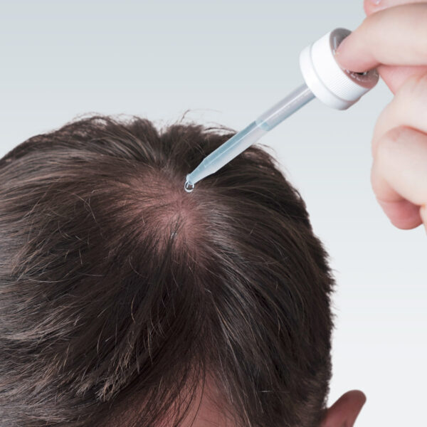 Hair Restoration Edmonton | Skin Physicians Dermatology